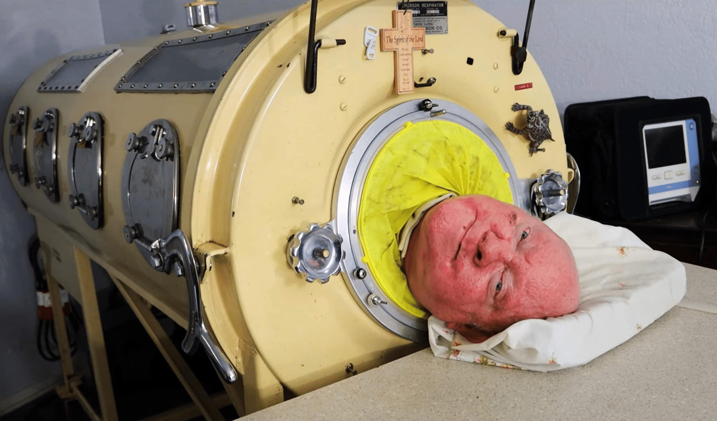 VIDEO: Muž žije 70 let zavřený v „železné plíci“. Přístroj, který ho ...